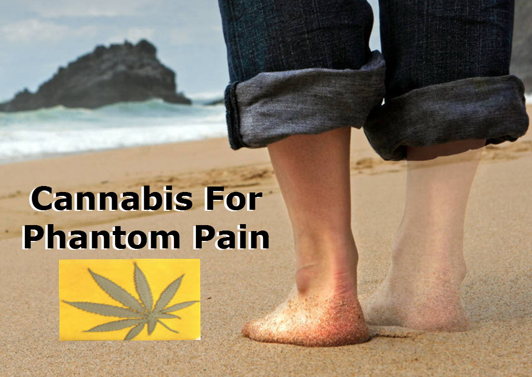 Cannabis For Phantom Pain