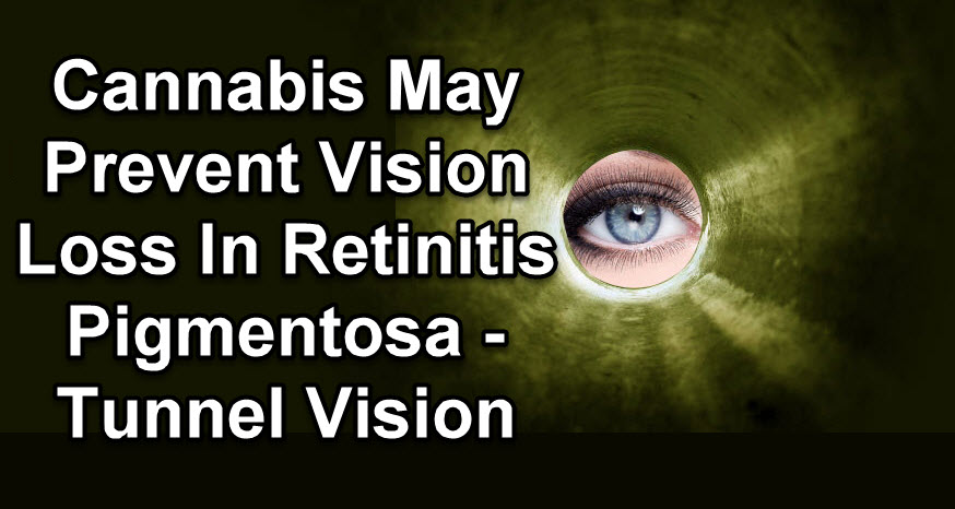 Cannabis May Prevent Vision Loss In Retinitis Pigmentosa
